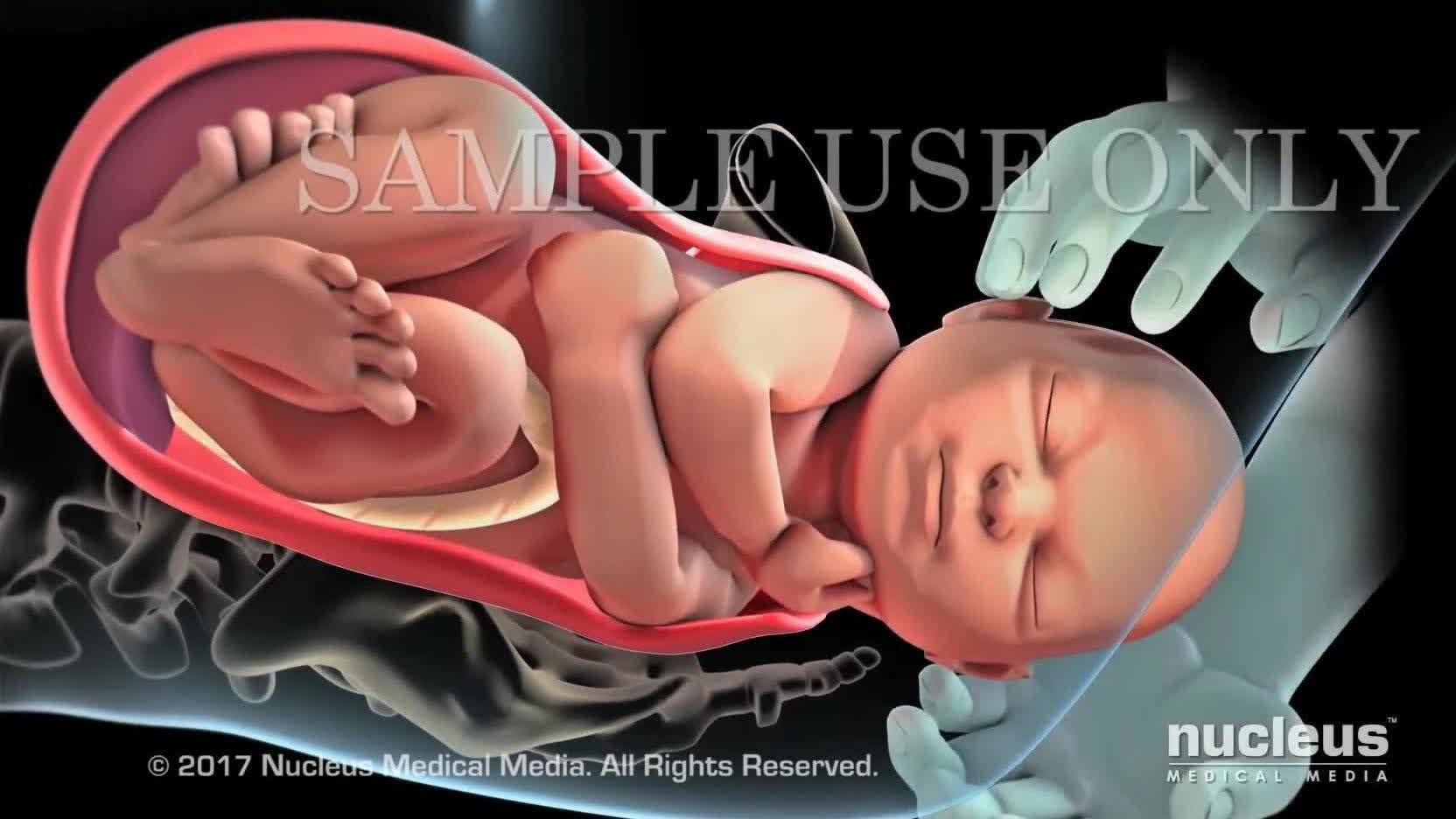 .b>医学动画】自然分娩全过程(原版英文