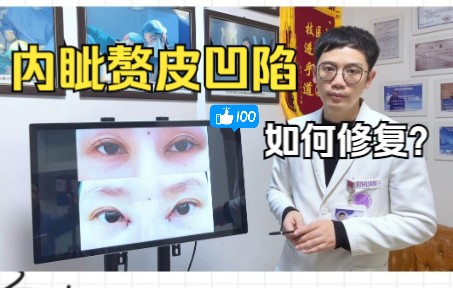 内眦赘皮凹陷应该怎么修复?