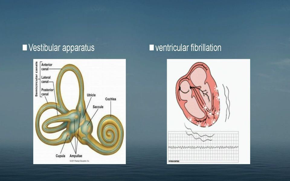 专业医学英语术语单词笔记本——今天讲V