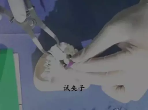 346 橡皮障操作-山西医科大学口腔医院