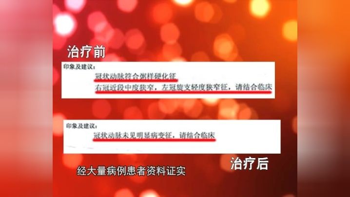 斑块可以完全堵塞血管并造成血栓!怎样有效逆转