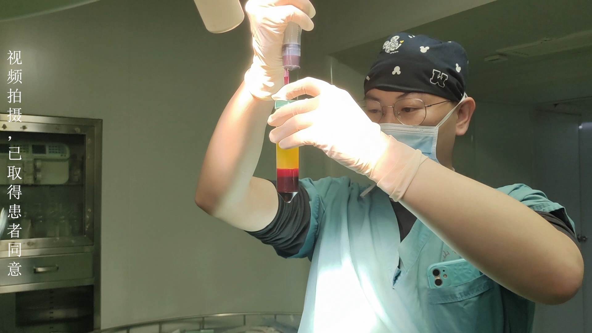 膝关节炎PRP治疗