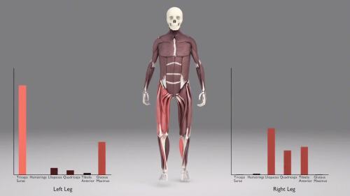 步态分析 人体结构 体态纠正 运动解剖