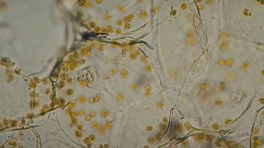 病毒的发现,病毒的真相到底是什么