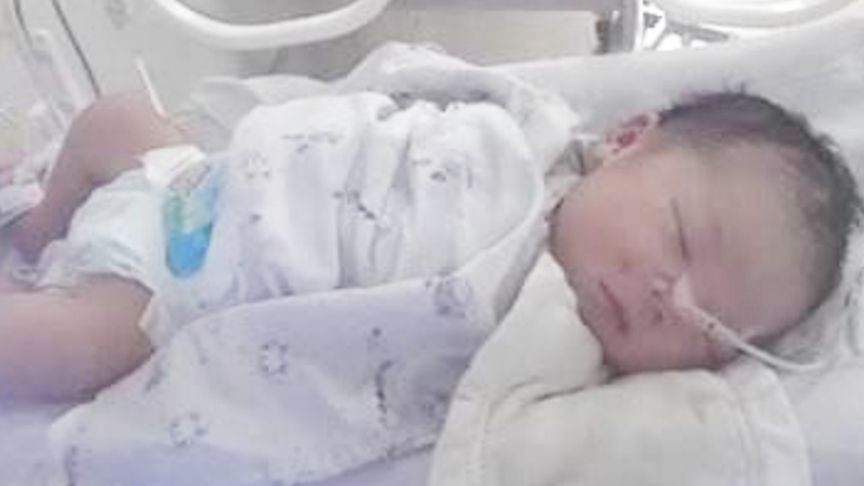 宝宝出生时十分健康,但没过多久就长出一条“尾巴”,到底咋了?