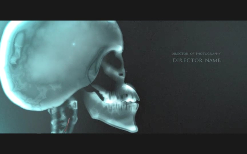 AE模板-医疗宣传纪录片后现代艺术效果的电影预告片模板 医院医学...