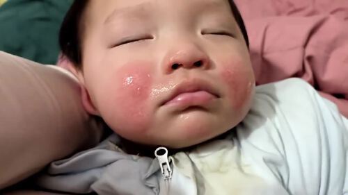 可爱暖糯的小宝宝,经过一次感冒,流鼻涕就变成了这种红猴屁屁孩