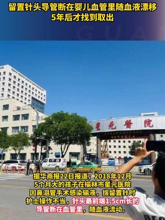 留置针头导管断在婴儿血管里随血液漂移,5年后才找到取出