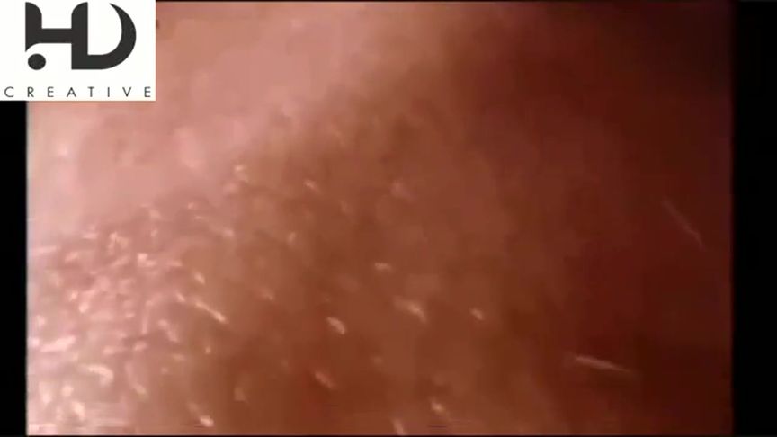 显微镜下看到皮肤的表面,像另一个星球,居住着可怕的小细菌!