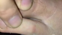 许通工作室修脚教学视频刀具的使用展示长期招收学徒‭187-5759-...