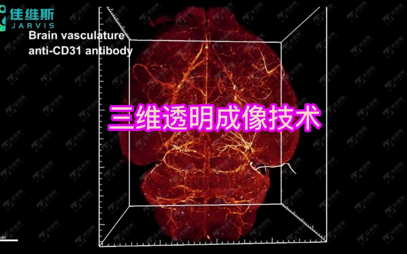 脑血管三维透明整体成像