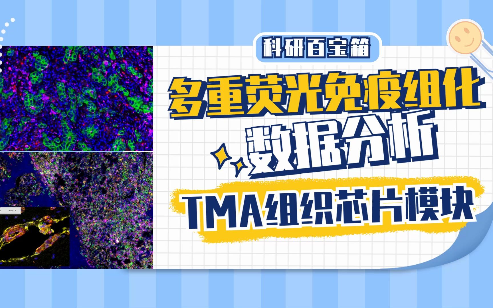 多重荧光免疫组化数据分析——TMA组织芯片模块