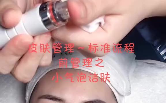 小气泡的正确使用方法…大油脸,用果酸、水杨酸给你的皮肤洗个澡吧...