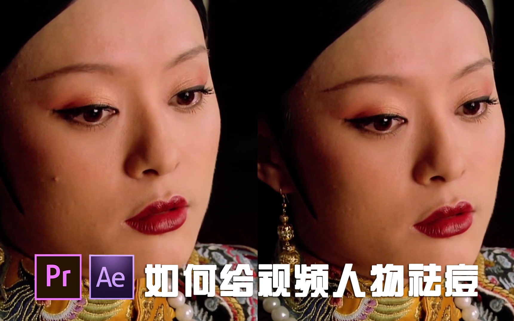 【后期教程】如何p掉视频中人物脸上的痘痘