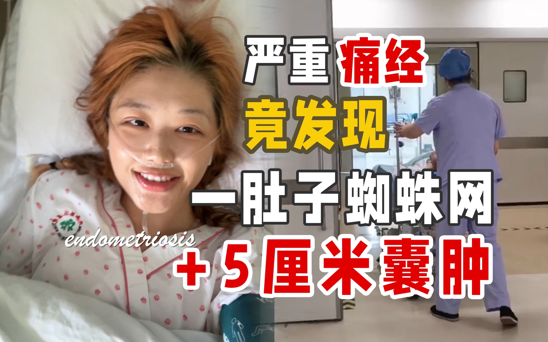 每10个女性1个得?手术动了4个器官组织?被严重忽视的疾病:子宫内膜...