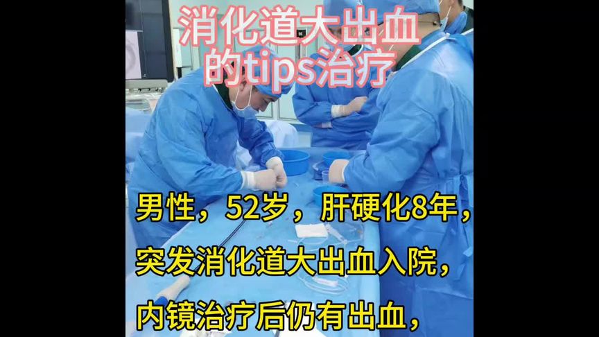 消化道大出血的Tips手术治疗