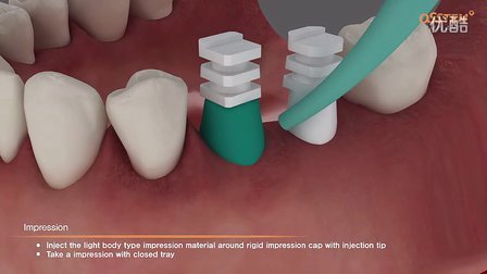 奥齿泰 转移基台操作动画片