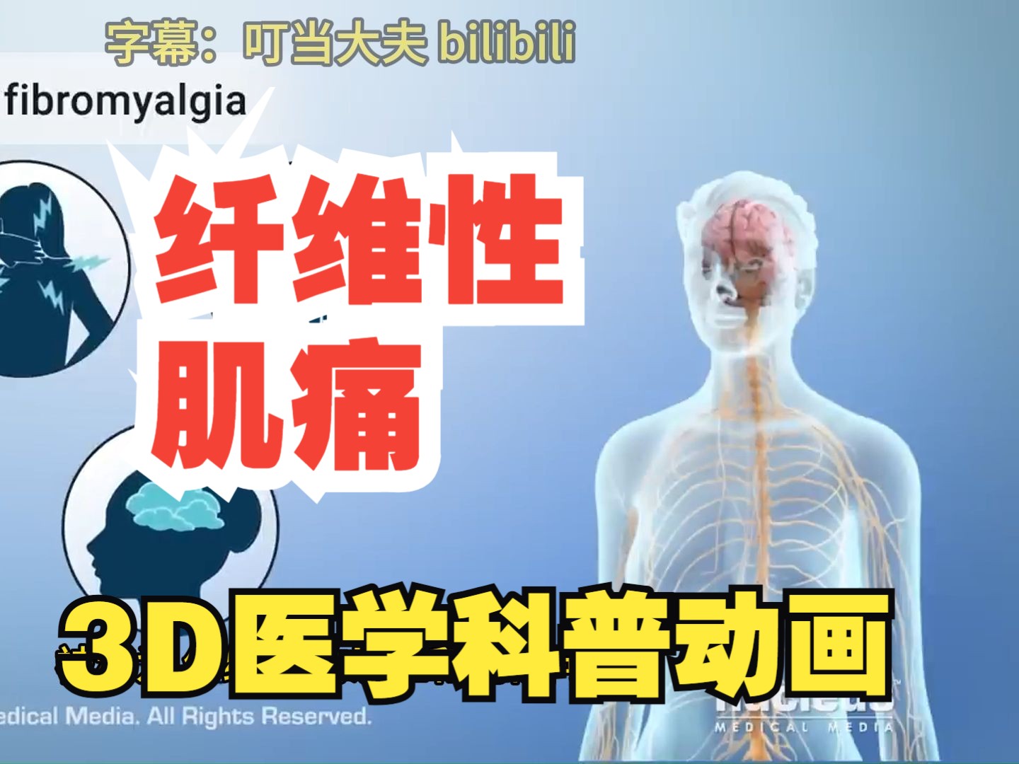 无形疼痛!纤维性肌痛 3D科普动画(nucleus医学科普视频系列)中文翻译