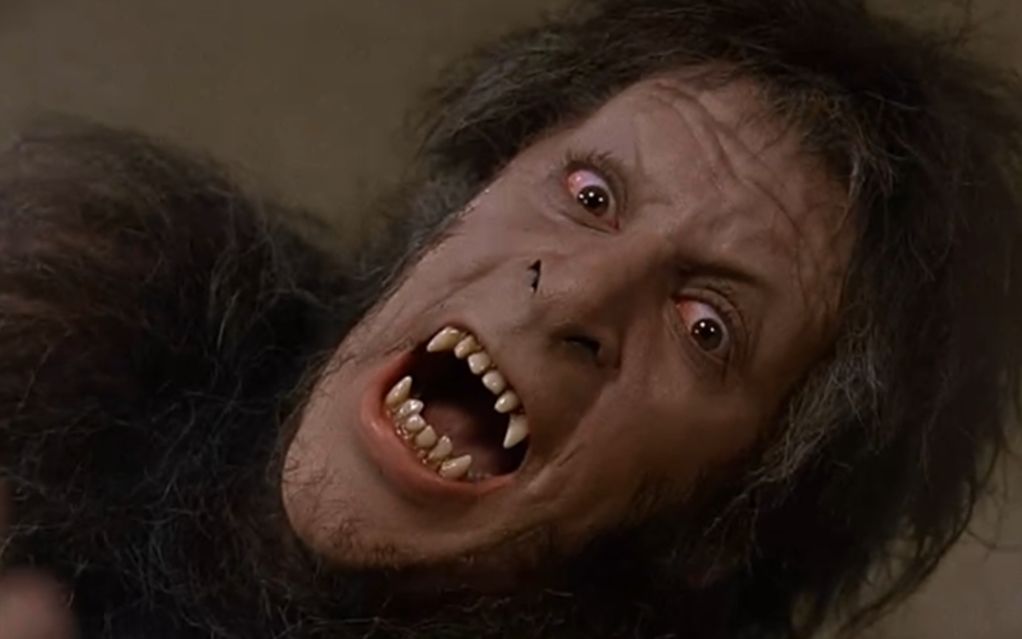 小伙野外被动物咬伤,月圆之夜竟长出毛发,并发疯似地攻击人类!