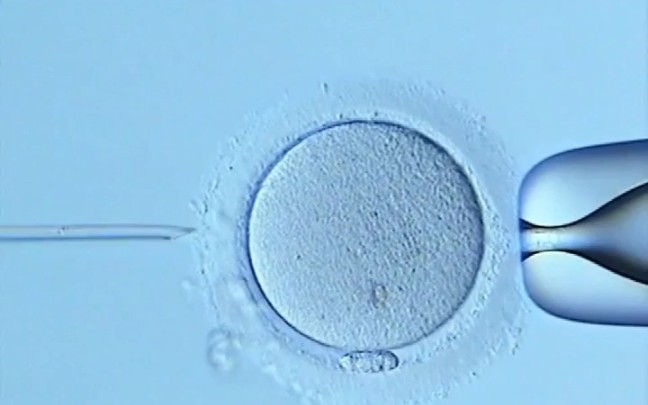 (科普)试管婴儿受精,长成试管胚胎的全过程!