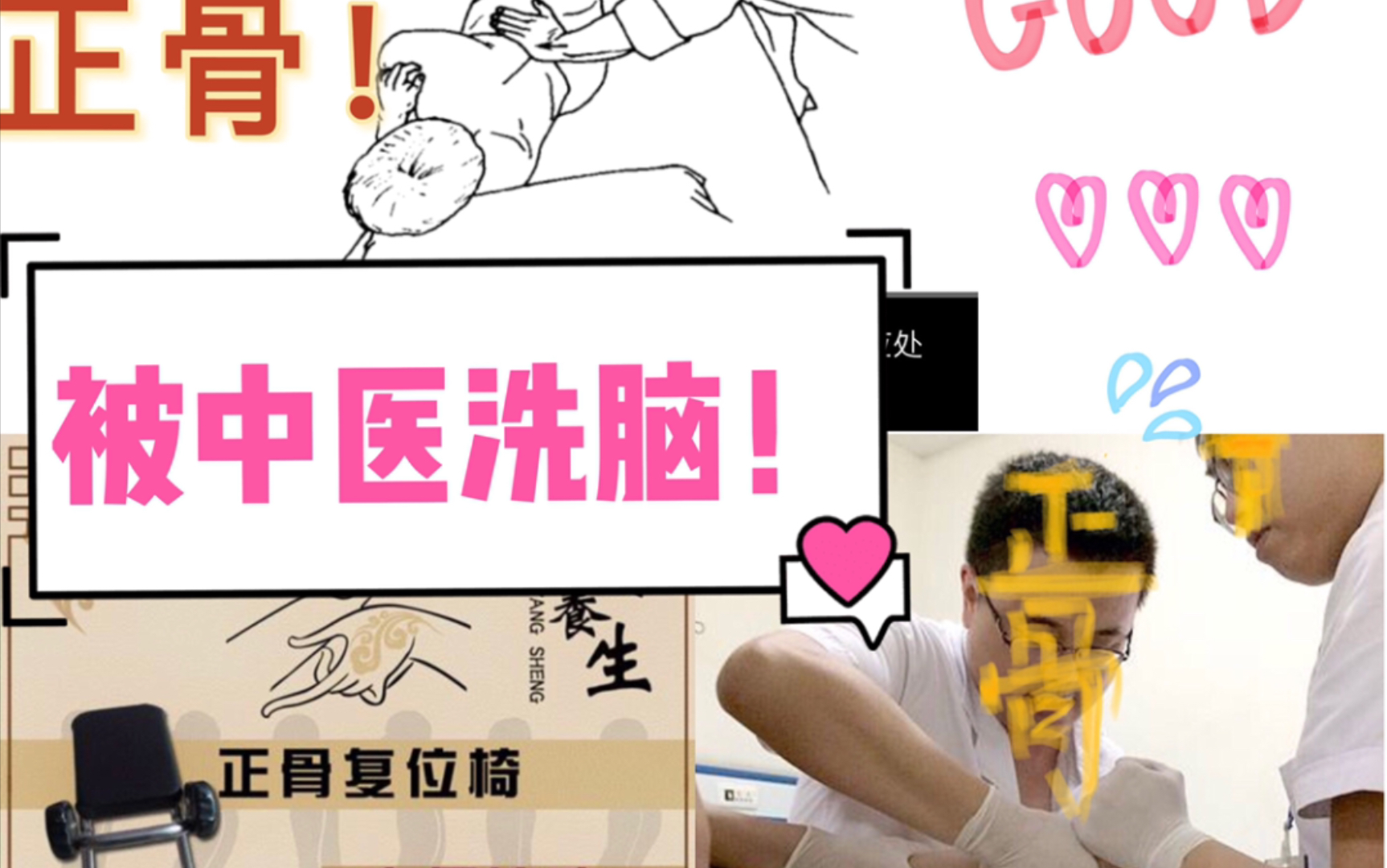 西医学生被中医洗脑了!第一次见纯正正骨!我都替病人疼!