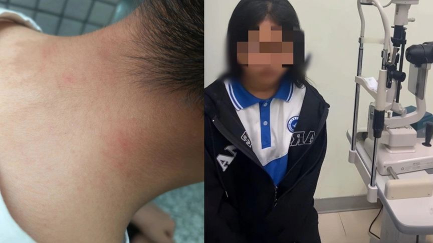 小学教室紫外线消毒灯亮起2小时,致50余名学生眼睛、面部受伤