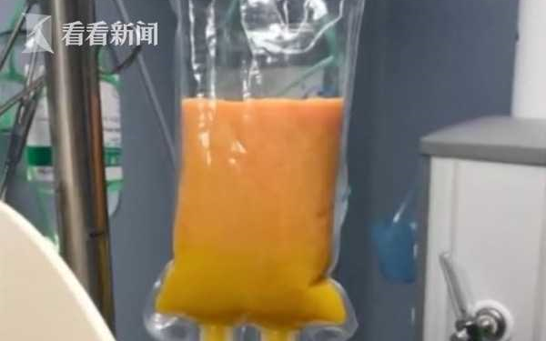 孕妇进ICU体内滤出数袋油脂!医生:最近吃的油炸物只是诱因