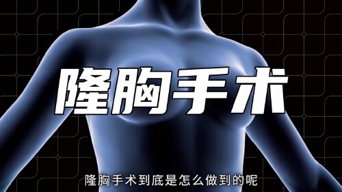 隆胸手术是怎么做的3D动画展示隆胸手术的全过程