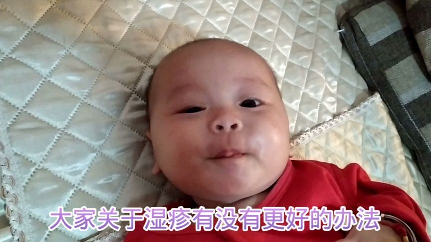 从出生到现在一直长湿疹 用了很多种药膏 反反复复 效果不理想