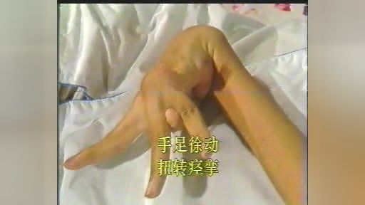 神经系统检查——不自主运动