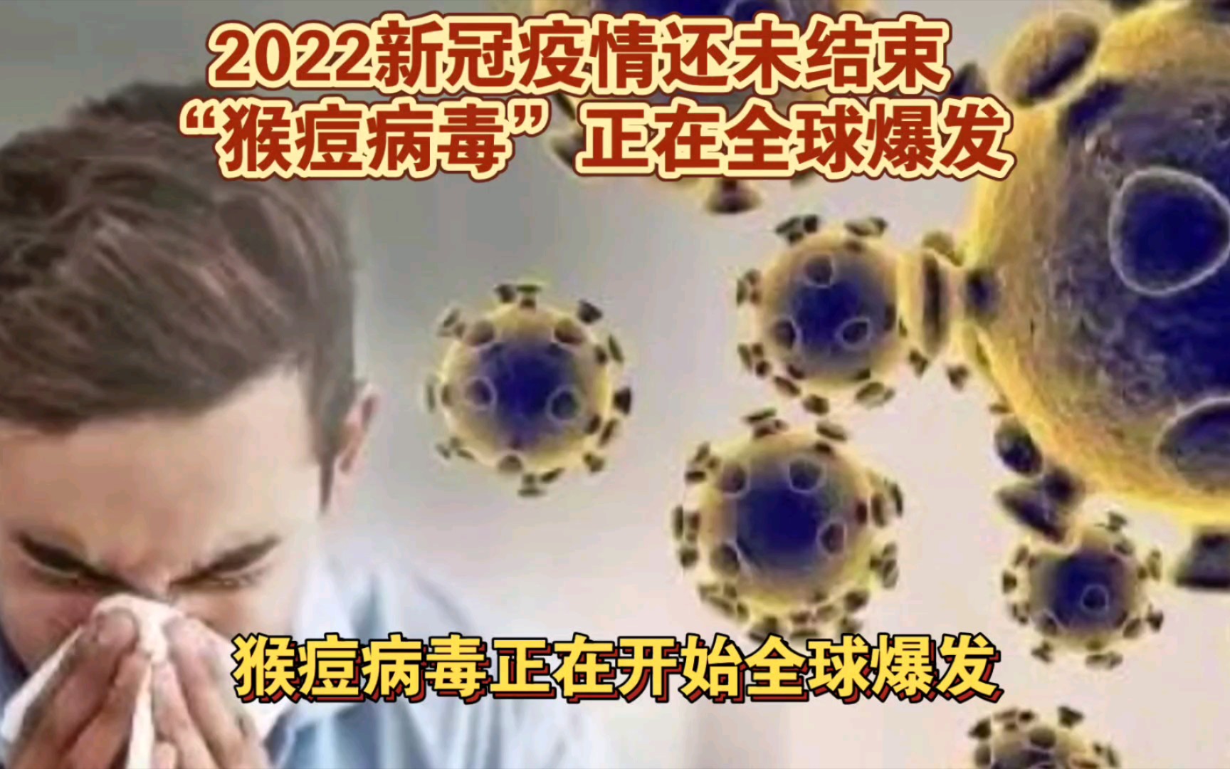 2022新冠疫情还未结束,“猴痘病毒”正在全球爆发