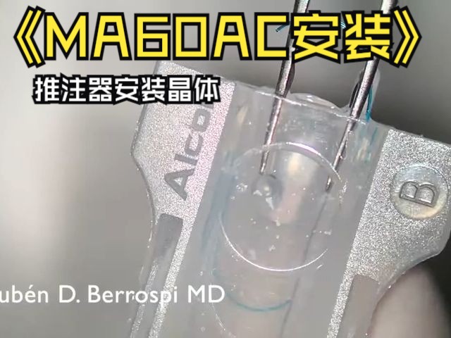 【MA60人工晶体推注器安装】Correcto montaje de lente MA60AC en ...