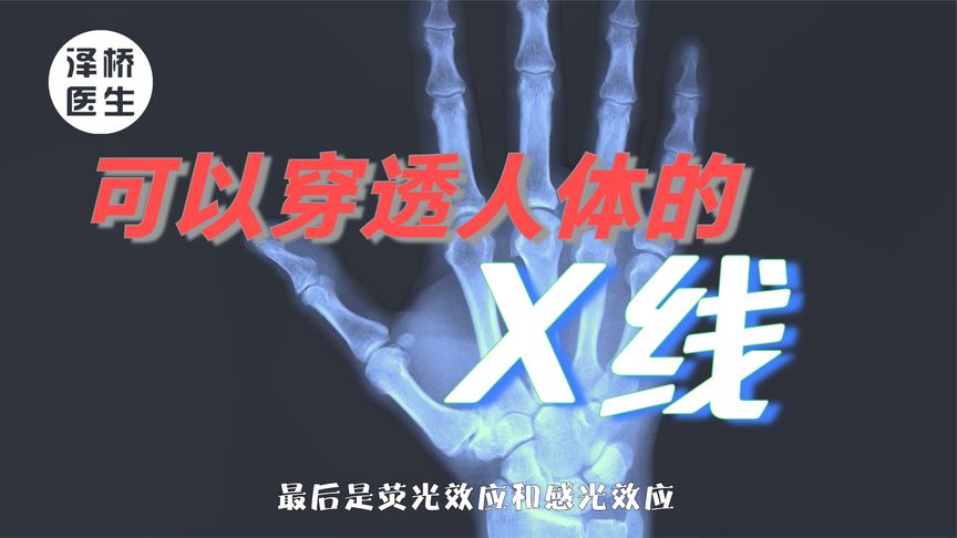 拍X光片到底有多大辐射?对人体是否有害?视频为你解答