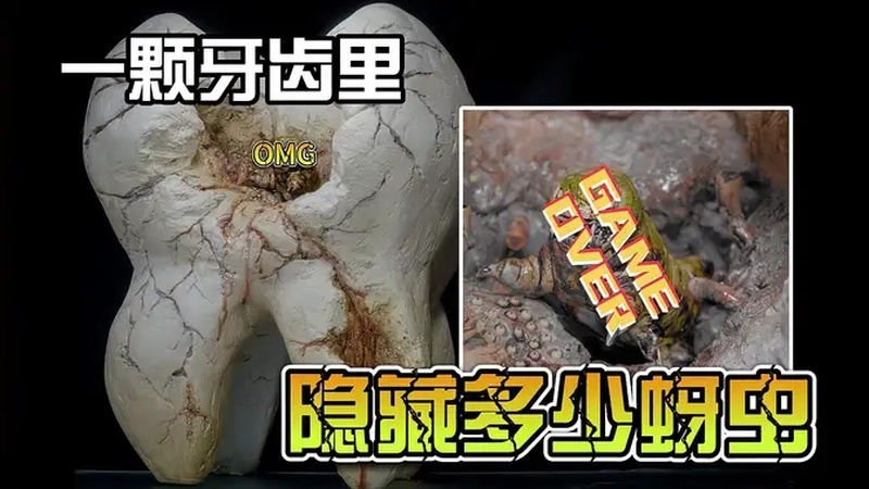 模型制作:牙齿里的可怕寄生虫,危害有多大?