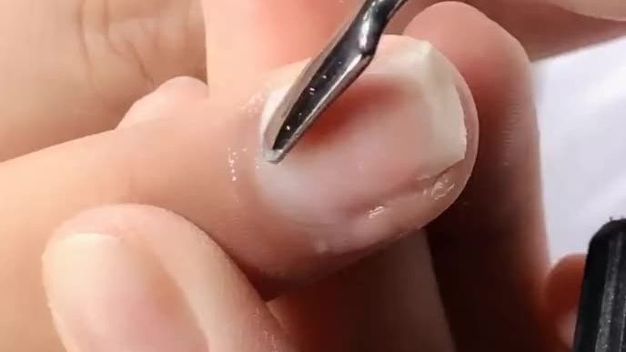 每次看见去死皮的视频,就想到我的手,真的很疼