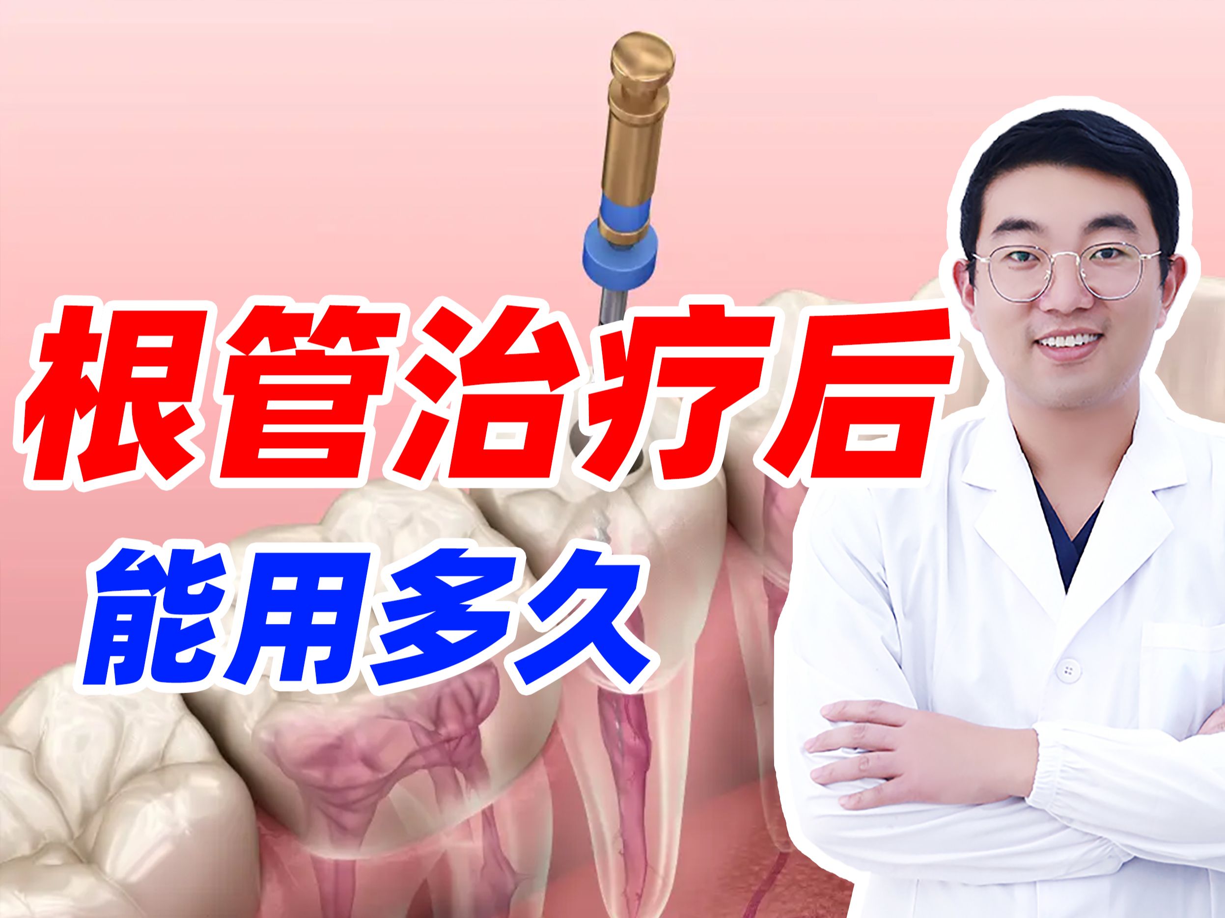 根管治疗后能用多久?