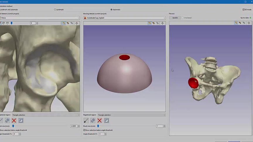 Simpleware 3D可视化软件,用于生命科学和高级材料及制造应用