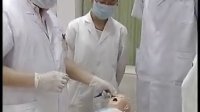 婴儿鼻饲管的放置