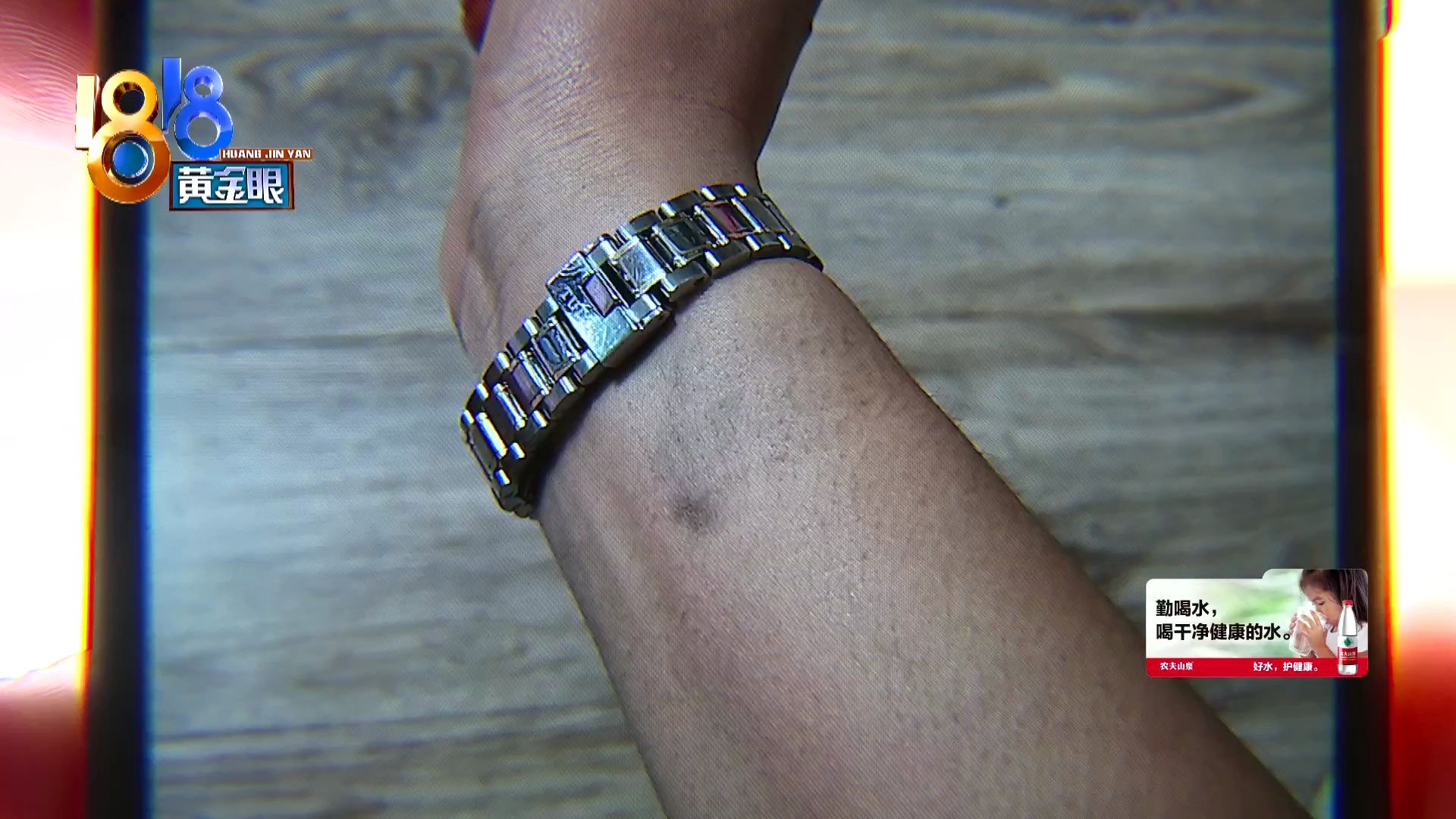 1818黄金眼【手表戴了将近一年 最近手腕频频发黑】