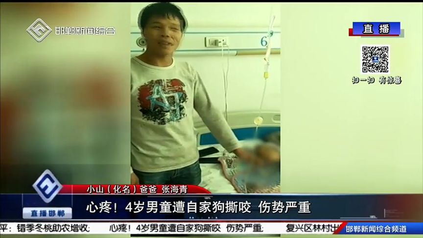 心疼!4岁男童遭自家狗撕咬 伤势严重