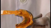 思创口腔 - DMG操作视频之三(硅橡胶取模II)