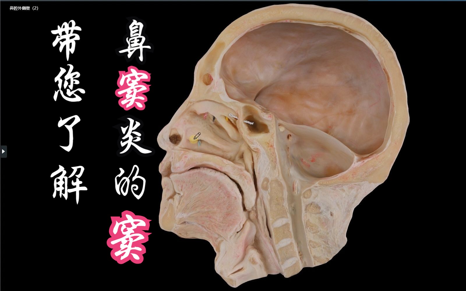带您了解:鼻窦炎的窦