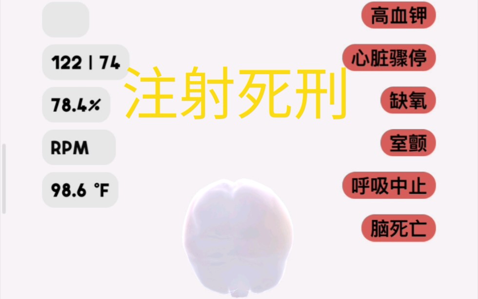 【生命LIFE】模拟注射死刑