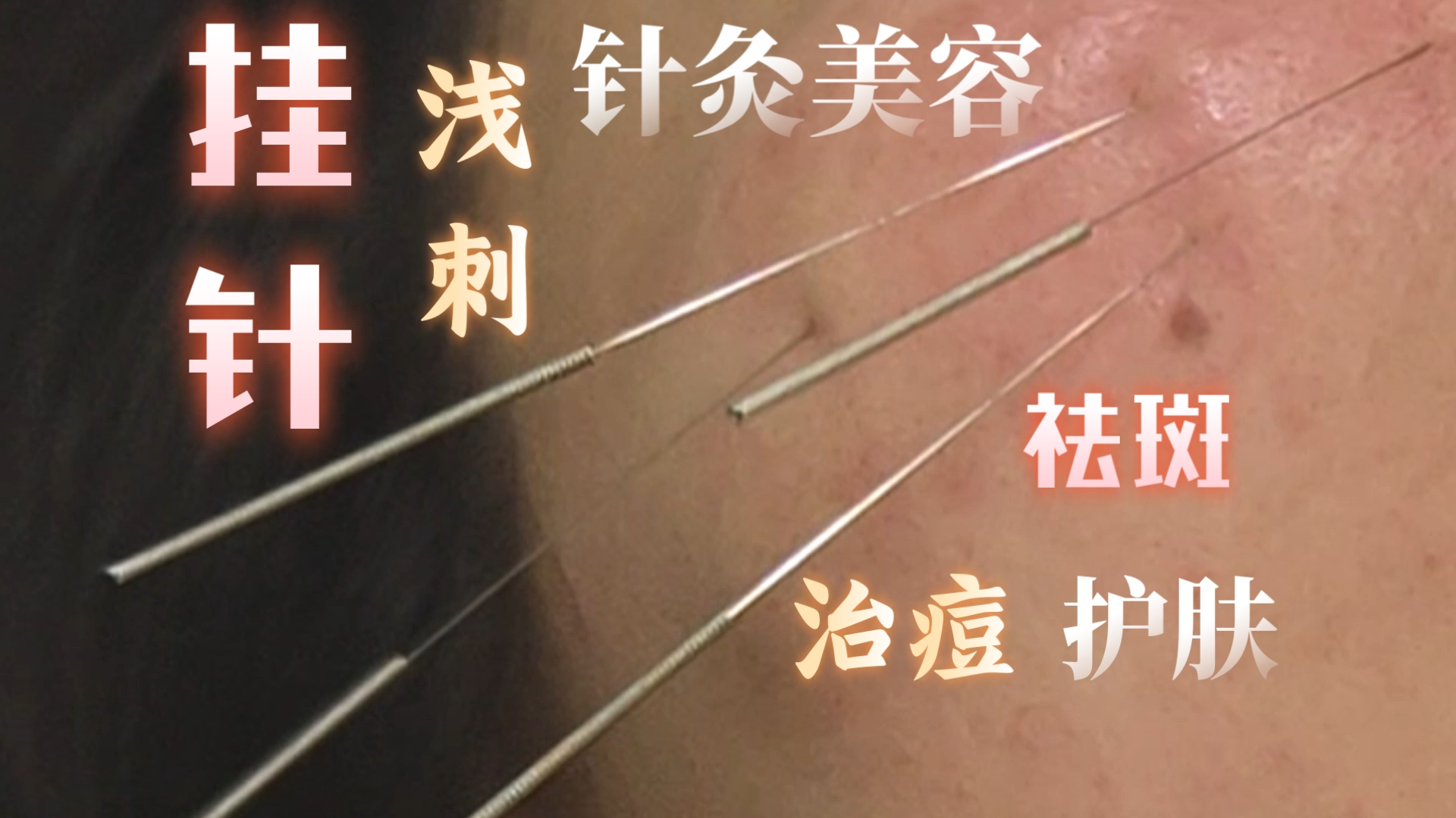 多针浅刺 | 皮肤救星