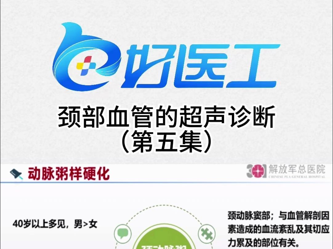 颈部血管的超声诊断(第五集)