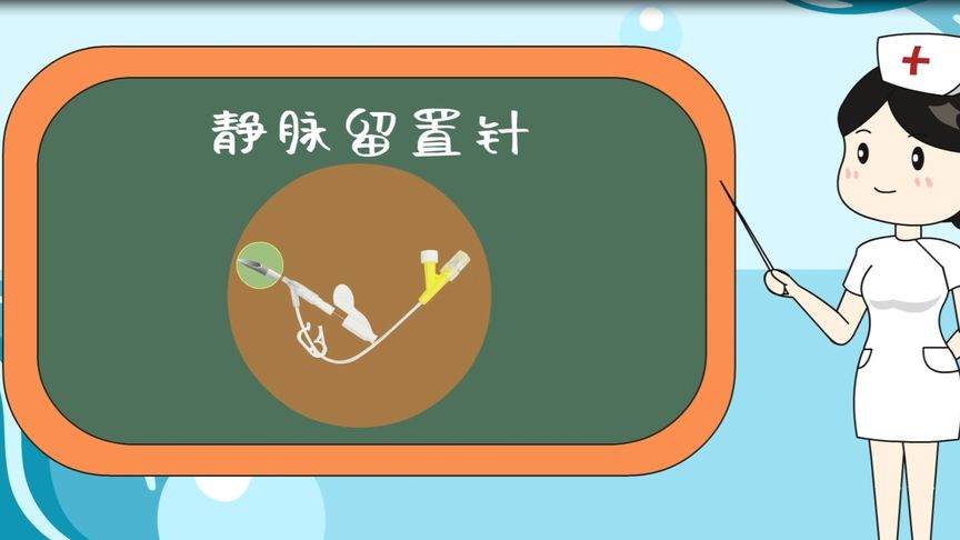 静脉留置针,降低输液疼痛,让输液更安全