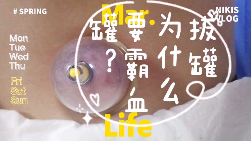 局部气滞血瘀 不舒适 就要拔罐 拔血罐