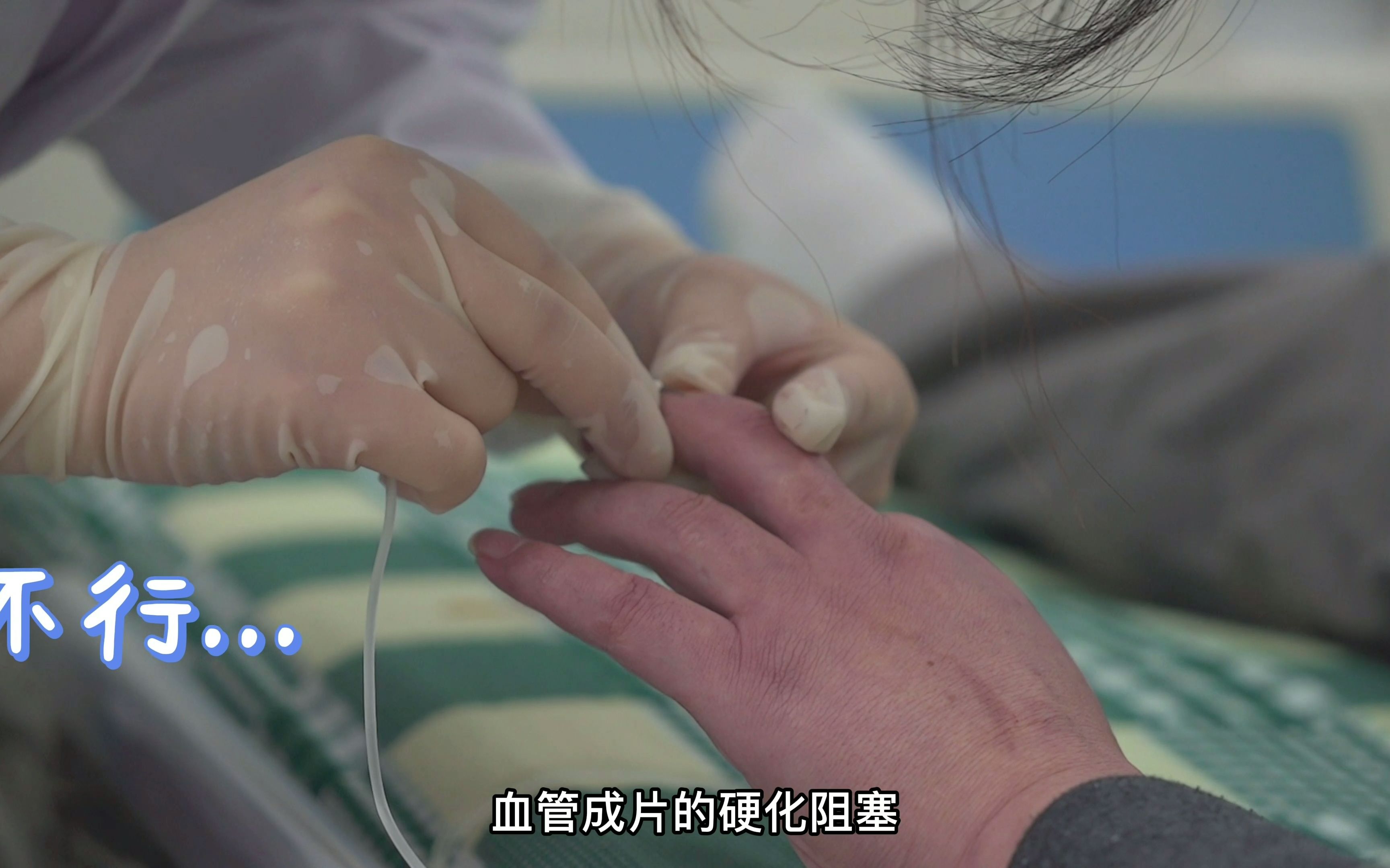 那些吸毒的人后来都怎么样了?注射吸毒把血管全打废了,真要治病时...