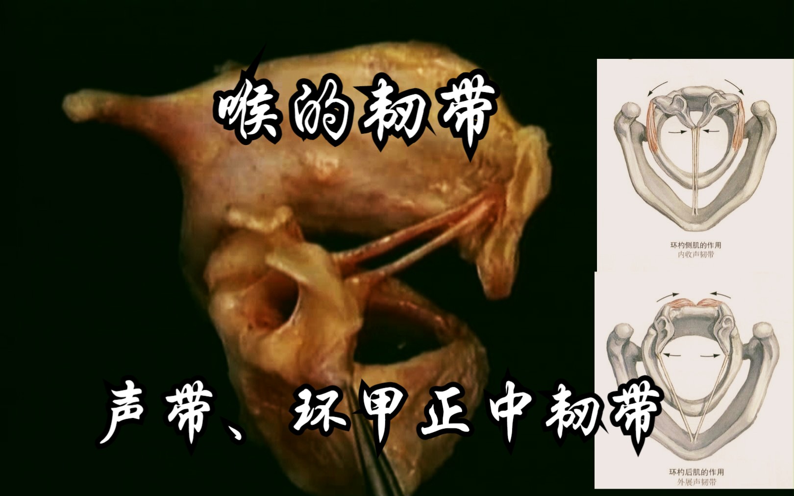 喉的韧带:声韧带、弹性圆锥