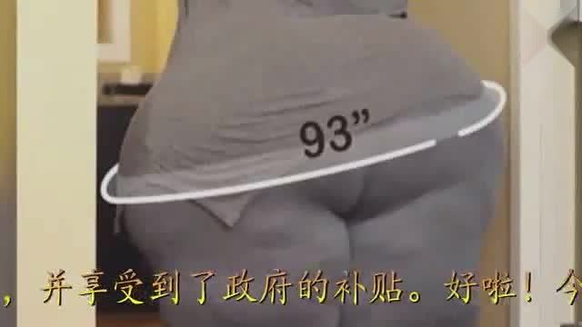 女子臀部竟有两米,行动不便被判为残疾,享有政府补贴